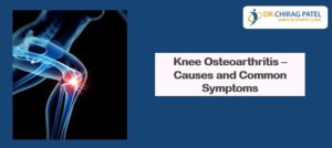 Knee Osteoarthritis - Causes and Common Symptoms