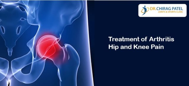 Treatment of Arthritis Hip and Knee Pain | Dr.Chirag Patel