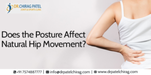 Does the Posture Affect Natural Hip Movement | Orthopedic Specialist Dr ...