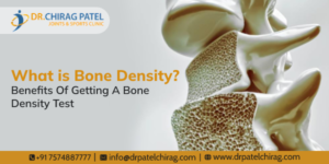 Bone Density Patient Information | Dr. Chirag Patel