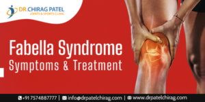 Understand the Fabella Syndrome Causes, Symptoms & Diagnosis