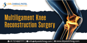 Multiligament Knee Reconstruction Surgery