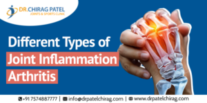 Joint Inflammation Arthritis Types and Treatment | Dr Chirag
